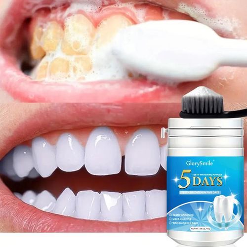 Beautiful Teeth Kit Whitening Alma 5 DAYS Teeth Sparling Natural Deep ...